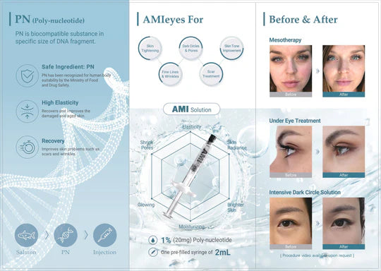 Ami Eyes – Polynucleotide Eye Rejuvenation Treatment – Rosvia.com